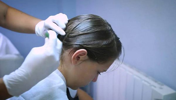Head Lice | South Lake Pediatrics