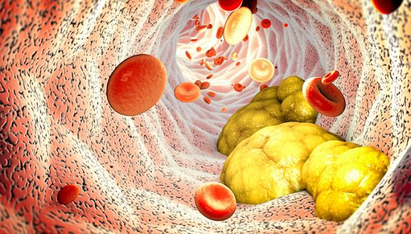 Fat and Cholesterol | South Lake Pediatrics